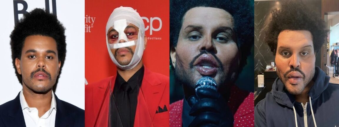 Did The Weeknd Get Plastic Surgery? Check Out His 'Creepy Look' In New ...