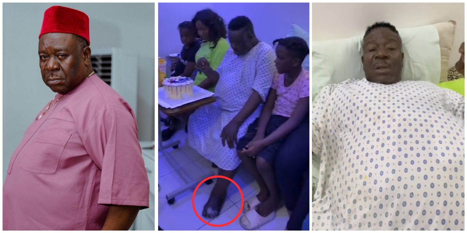 “I Don’t Want My Leg To Be Cut Off” – Mr Ibu Begs For Financial Help ...